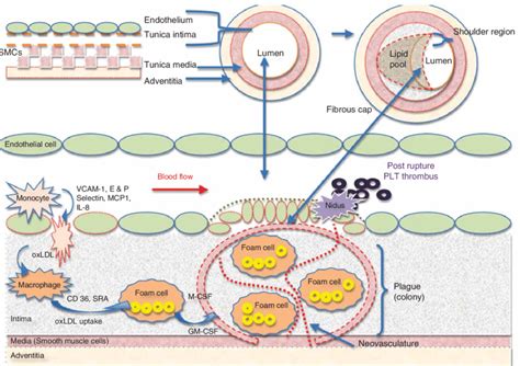 Schematic Representation Of The Arterial Wall Layers And The