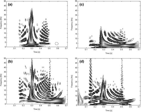 Ecg Arrhythmia Classification Using Time Frequency Distribution Techniques Pmc