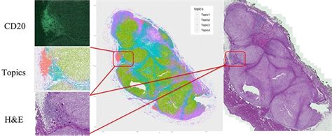 1303 spatial topic modeling of tumor microenvironment with multiplexed
