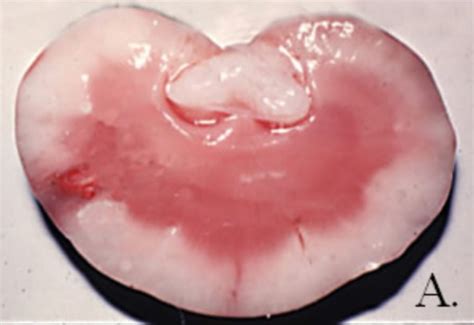 Lymphosarcoma College Of Veterinary Medicine