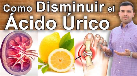 Consejos Bajar El Ácido Úrico Salud Videos