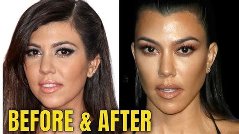 Kourtney Kardashian Antes E Depois