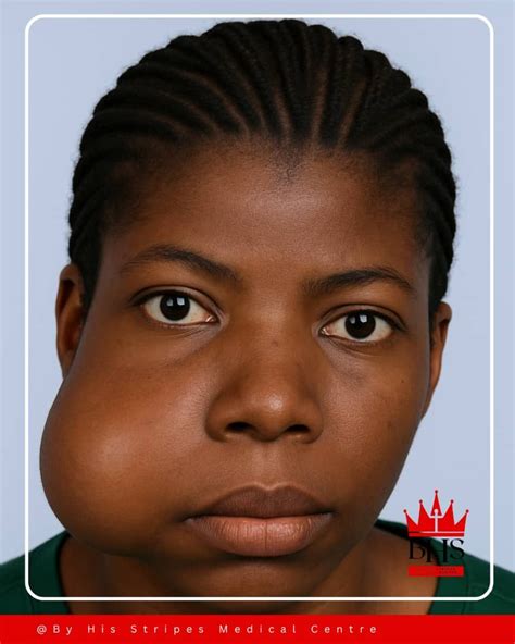 By Maxillofacial Conditions Like The One Shown Here Are More Than