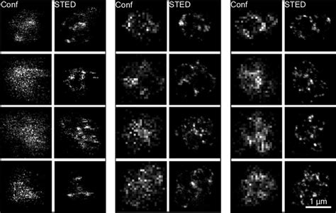 Sample Preparation Methods Living And Fixed Cell Labeling And Imaging