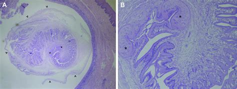 Taenia Solium Larvae
