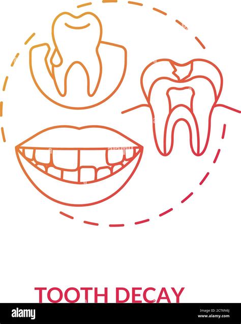 Tooth Decay Concept Icon Stock Vector Image And Art Alamy