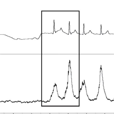 Pdf Volitional Control Of Reflex Cough