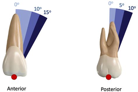 Types Of Orthodontic Tooth Movement