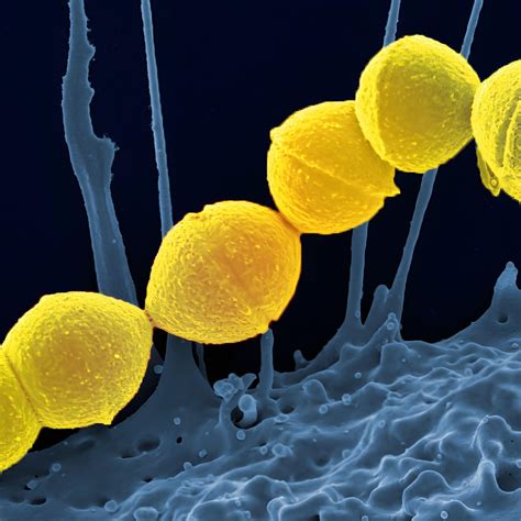 Strep Throat Virus What Is Strep Throat Symptoms Causes And