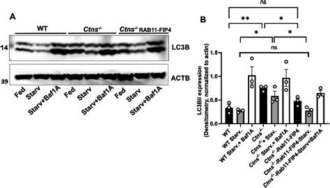 Reconstitution Of Rab11 Fip4 Expression Rescues Cellular Homeostasis In Cystinosis Pmc