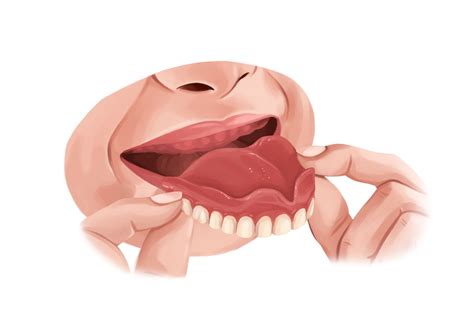 Dentures