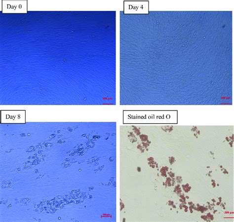 In Vitro Intramuscular Preadipocyte Differentiation Intramuscular Download Scientific Diagram