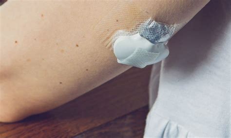 Insulin Patch How The Insulin Patch Works Challenges Research