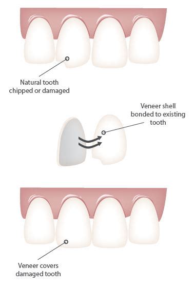 Cosmetic Dentist Bondi Junction — Boutique Dental Bondi