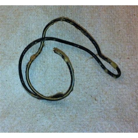 Electric Wire With Calcifications Removed By Bedside Cystoscopy Download Scientific Diagram