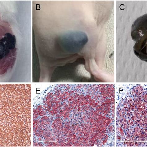 Tumorigenicity Mug Mel2 Growing In Nsg Mice A Black Tumor Was