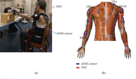 Figure From Motor Function Assessment Of Upper Limb In Stroke Patients Semantic Scholar