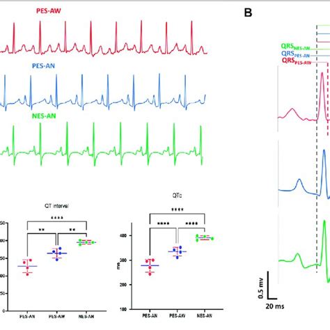 Effect Of Recording Methodology On Ecg Parameters A Example Lead