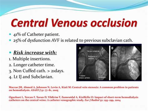 Tunnelled Cuffed Catheter Permacath Pptx