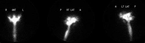 Mir Teaching File Case Cl003