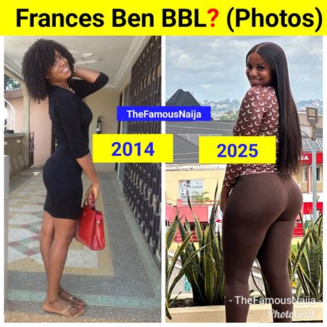 Frances Ben Bbl Surgery Old Photo Vs Recent Photo
