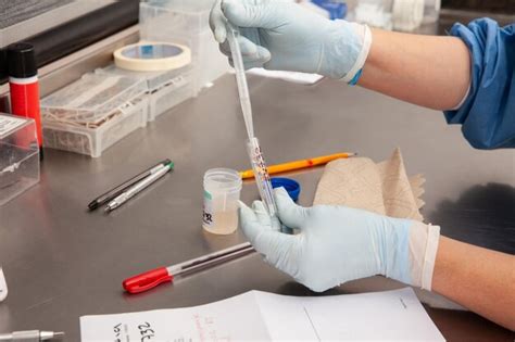 Premium Photo Scientist Preparing A Peritoneal Fluid Sample For