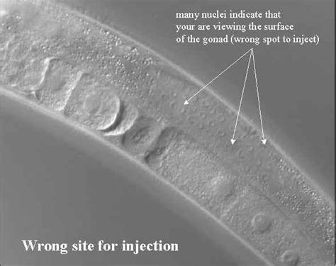 C Elegans Microinjection — The Open Lab Book V10