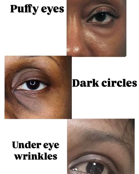 Abby 🤍 Ugc Creator On Instagram The Most Elite Eye Creams To