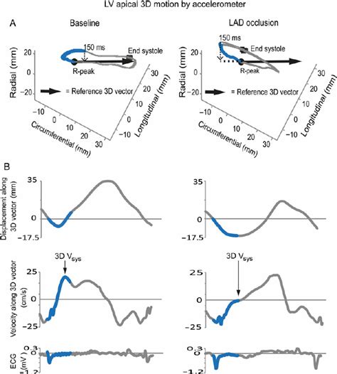 A Automatic Calculation Of Accelerometer 3d V Sys Accelerometer Download Scientific