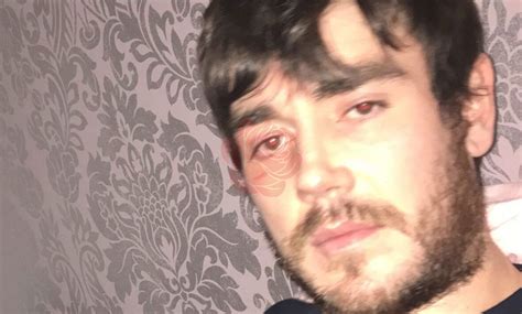 Dundee Rapist Sean Mcgowan Denied Parole In On Red Rose Uk