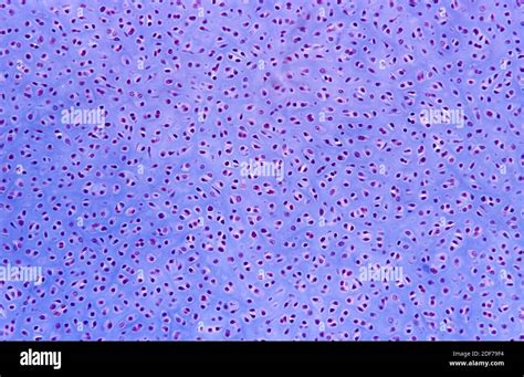 Hyaline Cartilage 400x Labeled