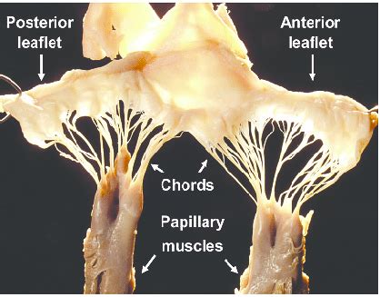 Anatomical Specimen Of Human Mitral Valve Consisting Of The Papillary