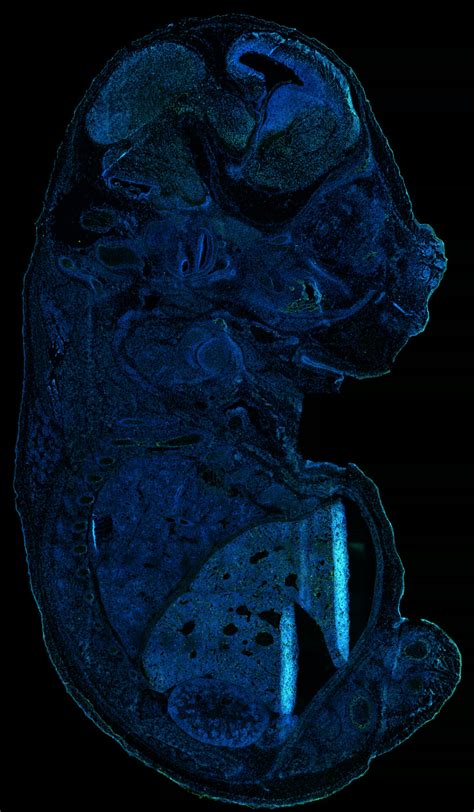 Mouse Embryo Section E15 5 Labeled With Icam1 Antibody Bicell Blue