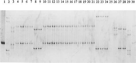 Single Stranded Conformational Polymorphism Patterns For Nalidixic
