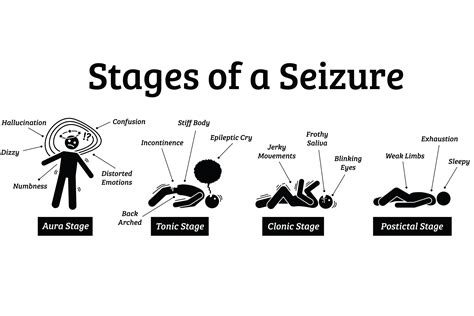 Epilepsy Wikipedia
