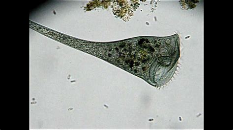 Stentor Under Microscope 400x