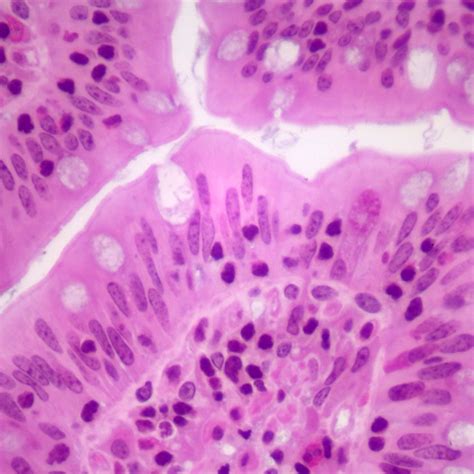Epithelial Skin Cells