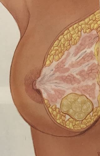 Clin Med Iv Exam Ii Obgyn Flashcards Quizlet