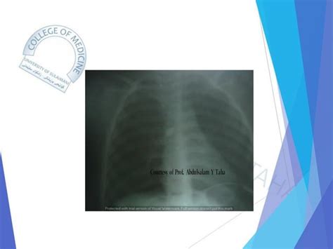 Bead In Right Main Stem Bronchuspdf