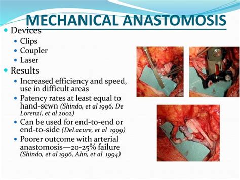 Microvascular Flaps For Reconstruction In Head And Neck Cancer Pptx