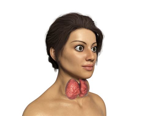 Exophthalmos Bulging Eyes Medical Definition Causes And Treatments