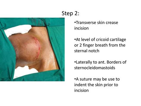 Surgical Management Of Benign Multinodular Goitre Pptx