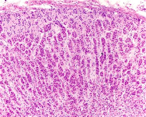 Human Adrenal Cortex Light Micrograph Stock Image C054 5759 Science Photo Library