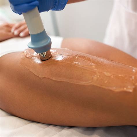 What Causes Cellulitis And Cellulite And Why Do They Appear On The Sa Sculptskin