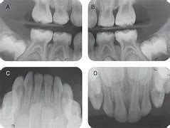 Bayside Ny Dentist