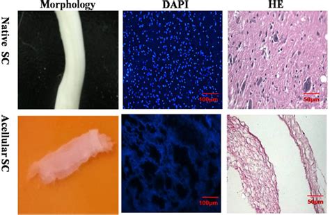 Thermo Sensitive Hydrogels Combined With Decellularised Matrix Deliver