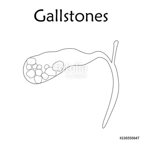 Gallbladder Drawing At Explore Collection Of