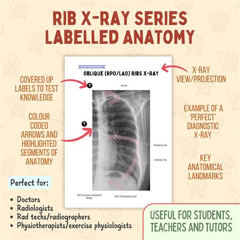 Posterior Ribs Anatomy Xray