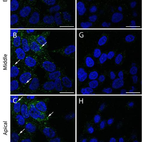 Syntaxin Protein Conformation Syntaxin Can Adopt An Open Conformation