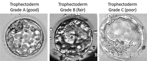 4cc级别的囊胚移植成功率高么？ 知乎